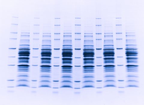Coomassie Blue Stain - Severn Biotech